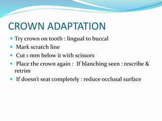 Stainless steel crowns | PPTX