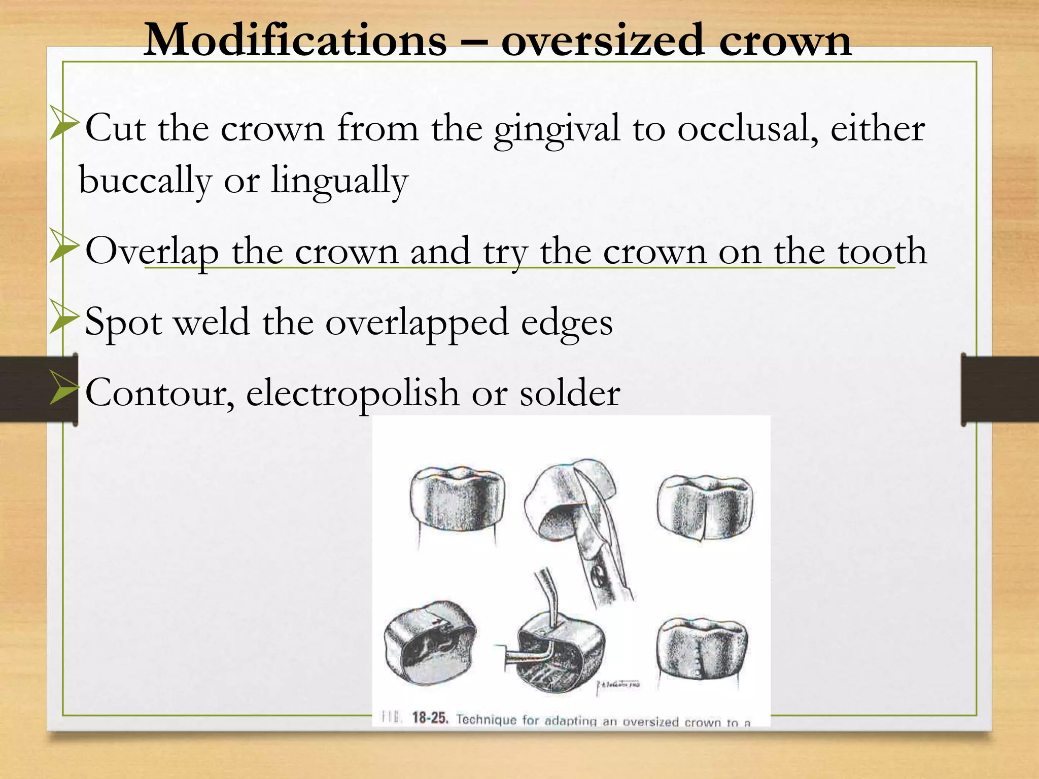 Stainless steel crowns | PPT