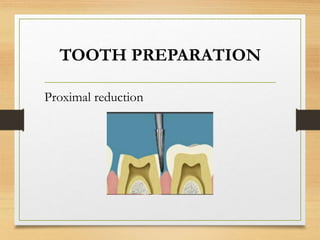 Stainless steel crowns | PPT