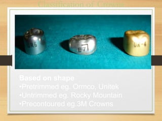 Stainless steel crowns | PPT