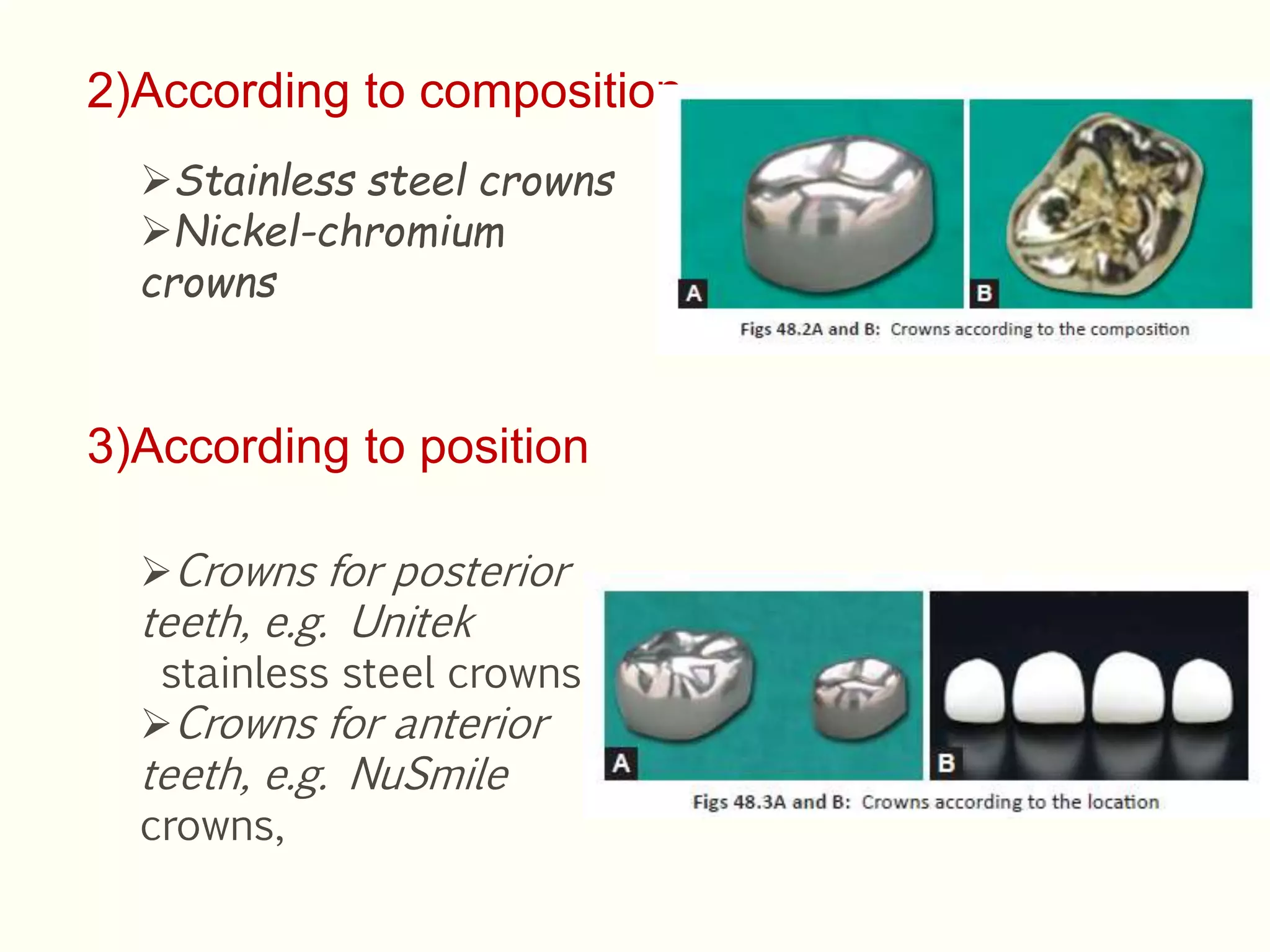 Stainless Steel Crowns | PPTX