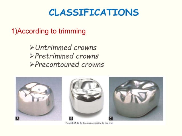 Stainless Steel Crowns | PPTX