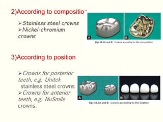 Stainless Steel Crowns | PPTX