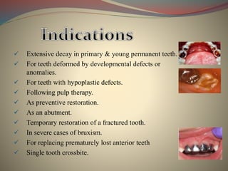 Stainless steel crowns | PPTX