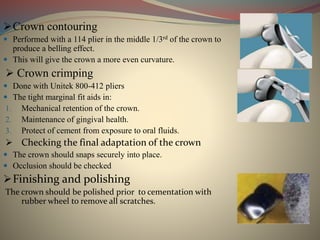 Stainless steel crowns | PPTX