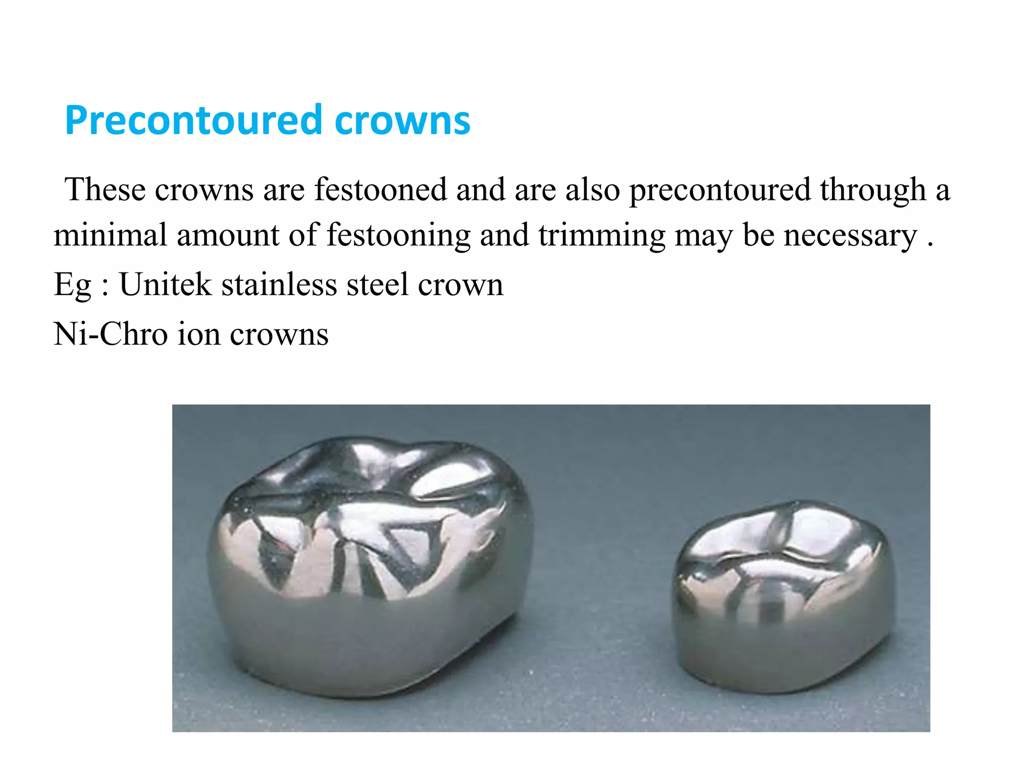 Stainless steel crowns in pediatric dentistry ppt | PPTX