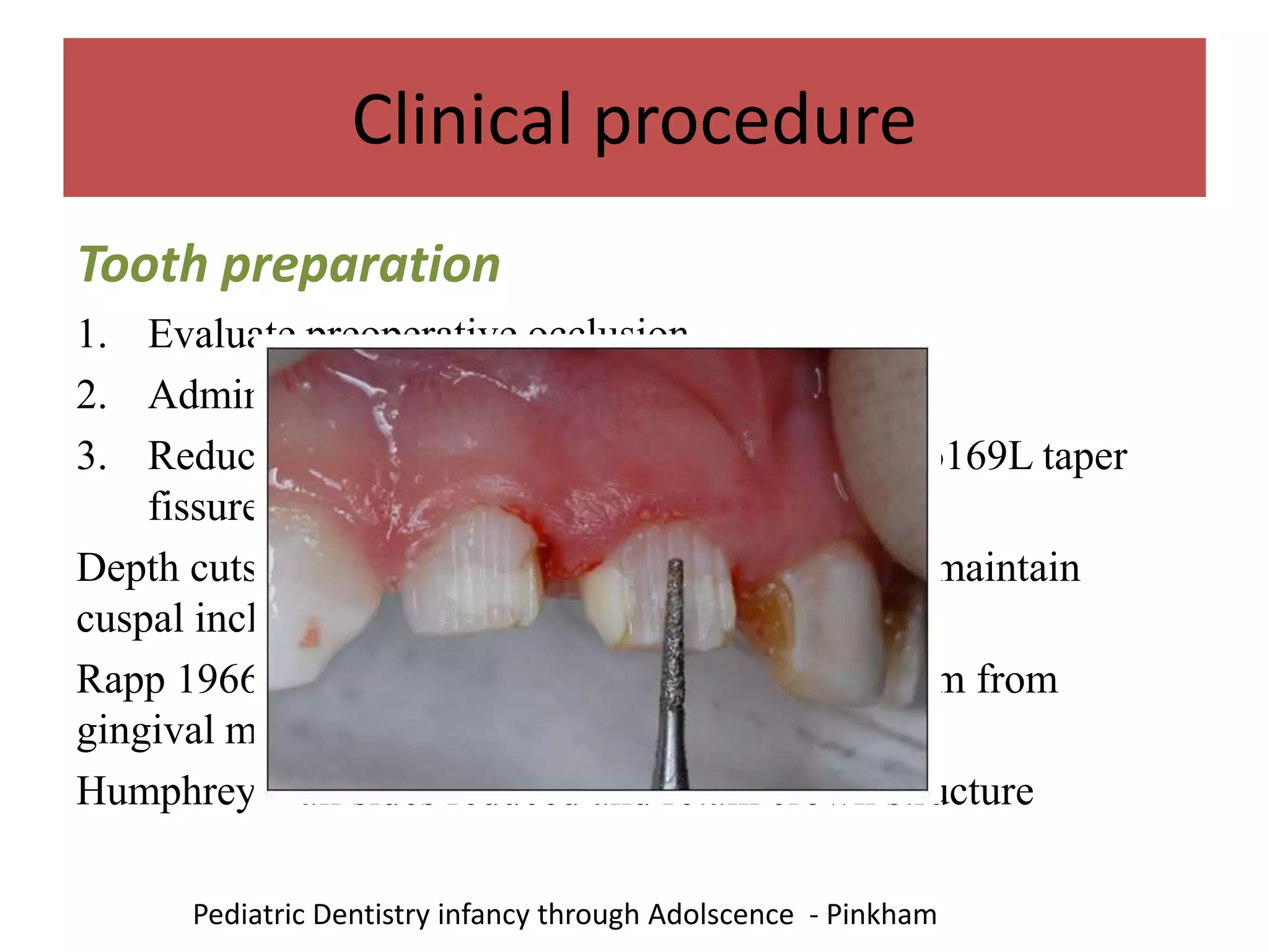 Stainless steel crowns in pediatric dentistry ppt | PPTX