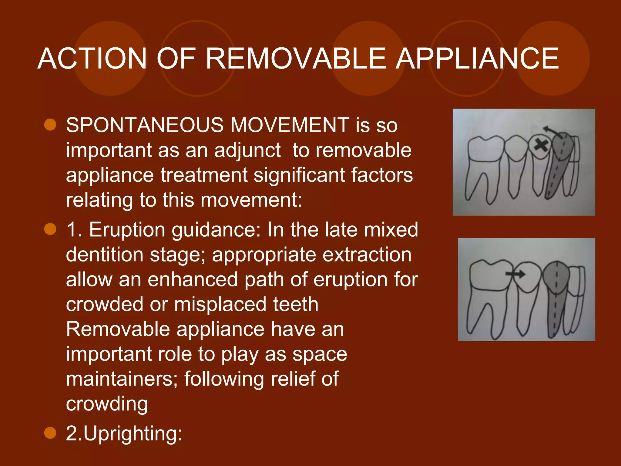 Stainless Steel + Removable Appliances | PPT