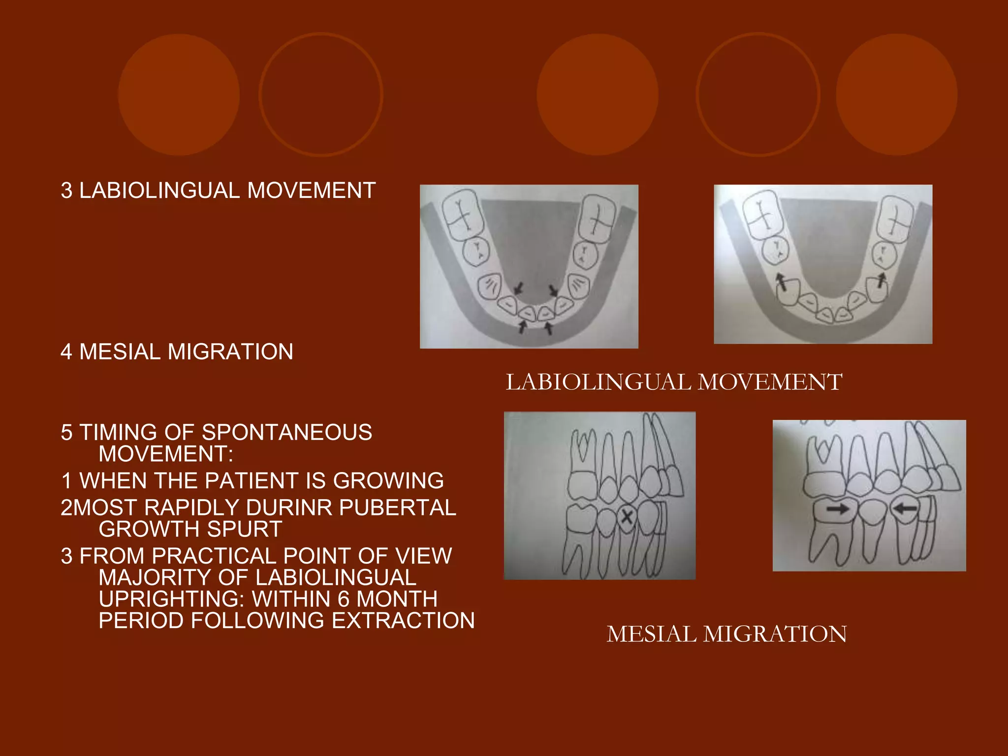 Stainless Steel + Removable Appliances | PPT