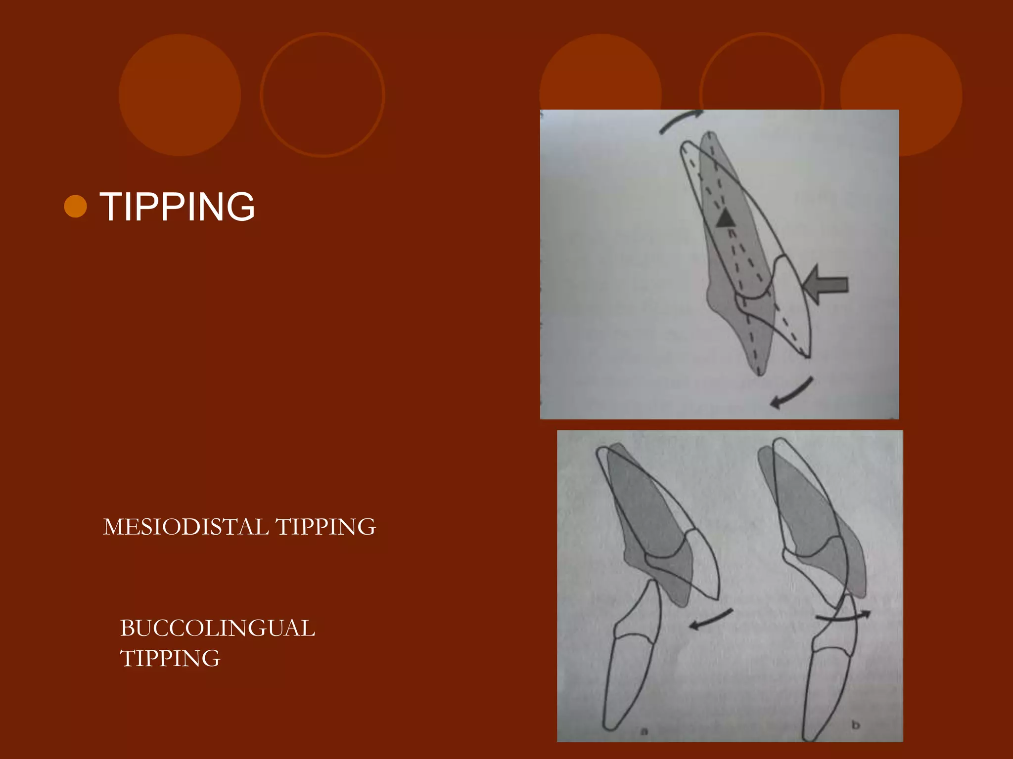 Stainless Steel + Removable Appliances | PPT