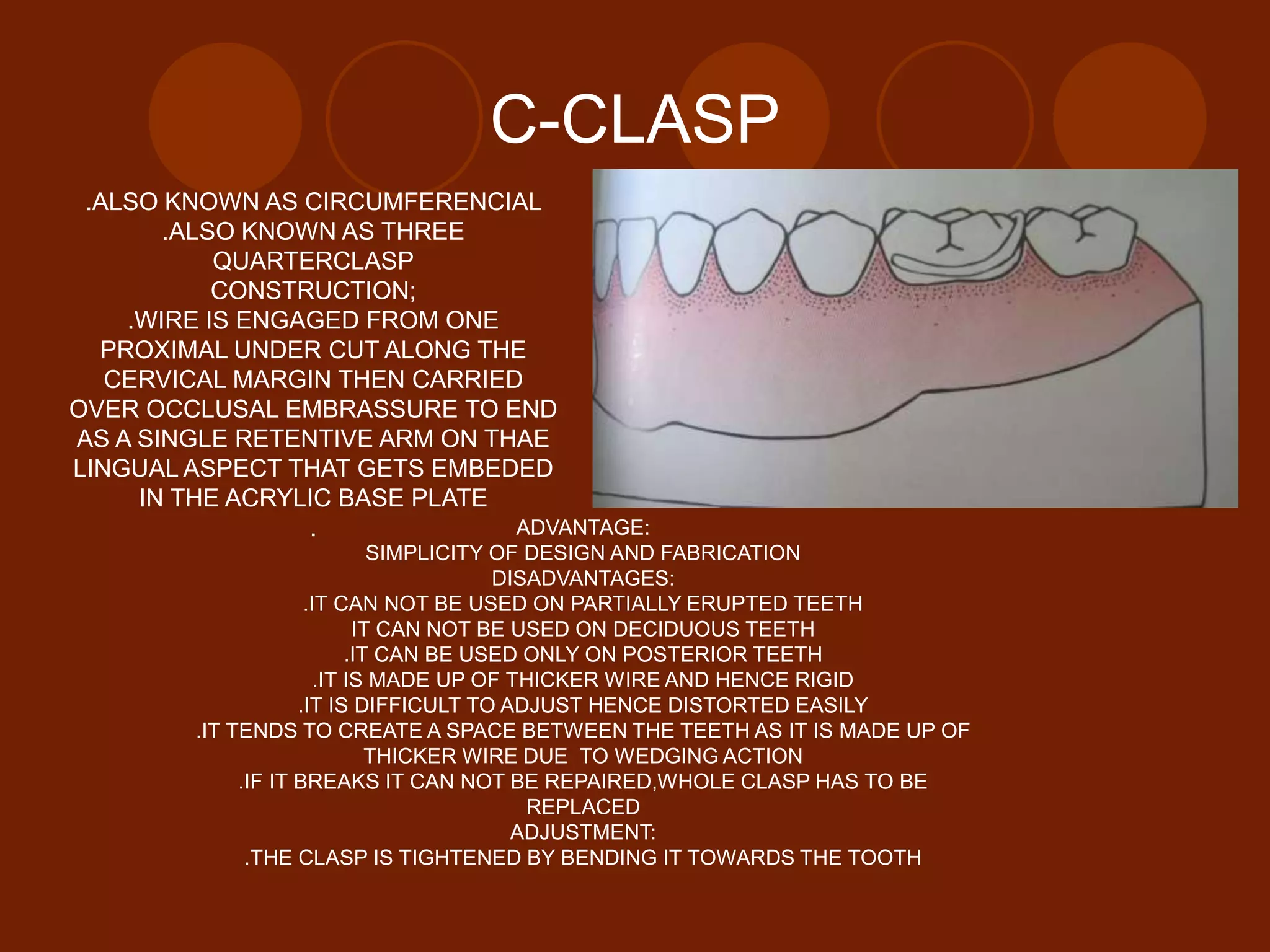 Stainless Steel + Removable Appliances | PPT