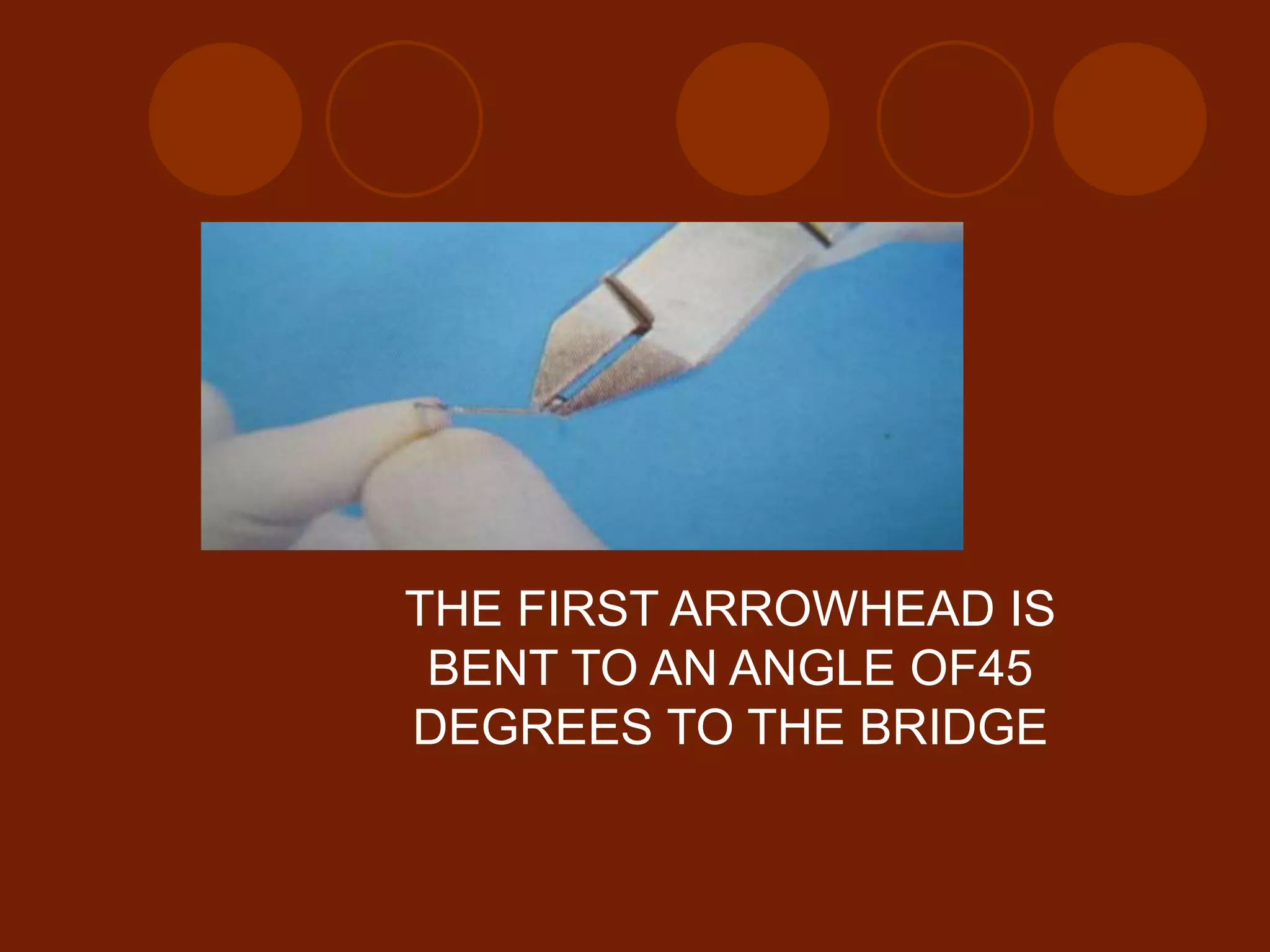 Stainless Steel + Removable Appliances | PPT