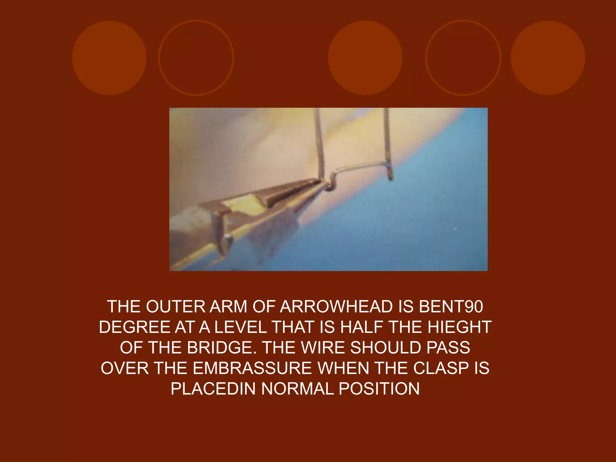 Stainless Steel + Removable Appliances | PPT