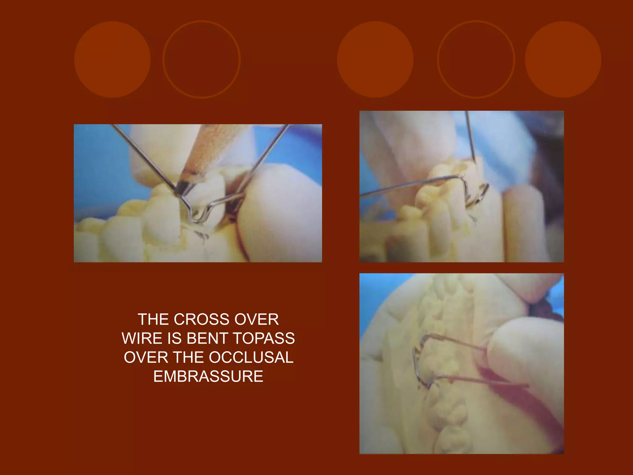 Stainless Steel + Removable Appliances | PPT