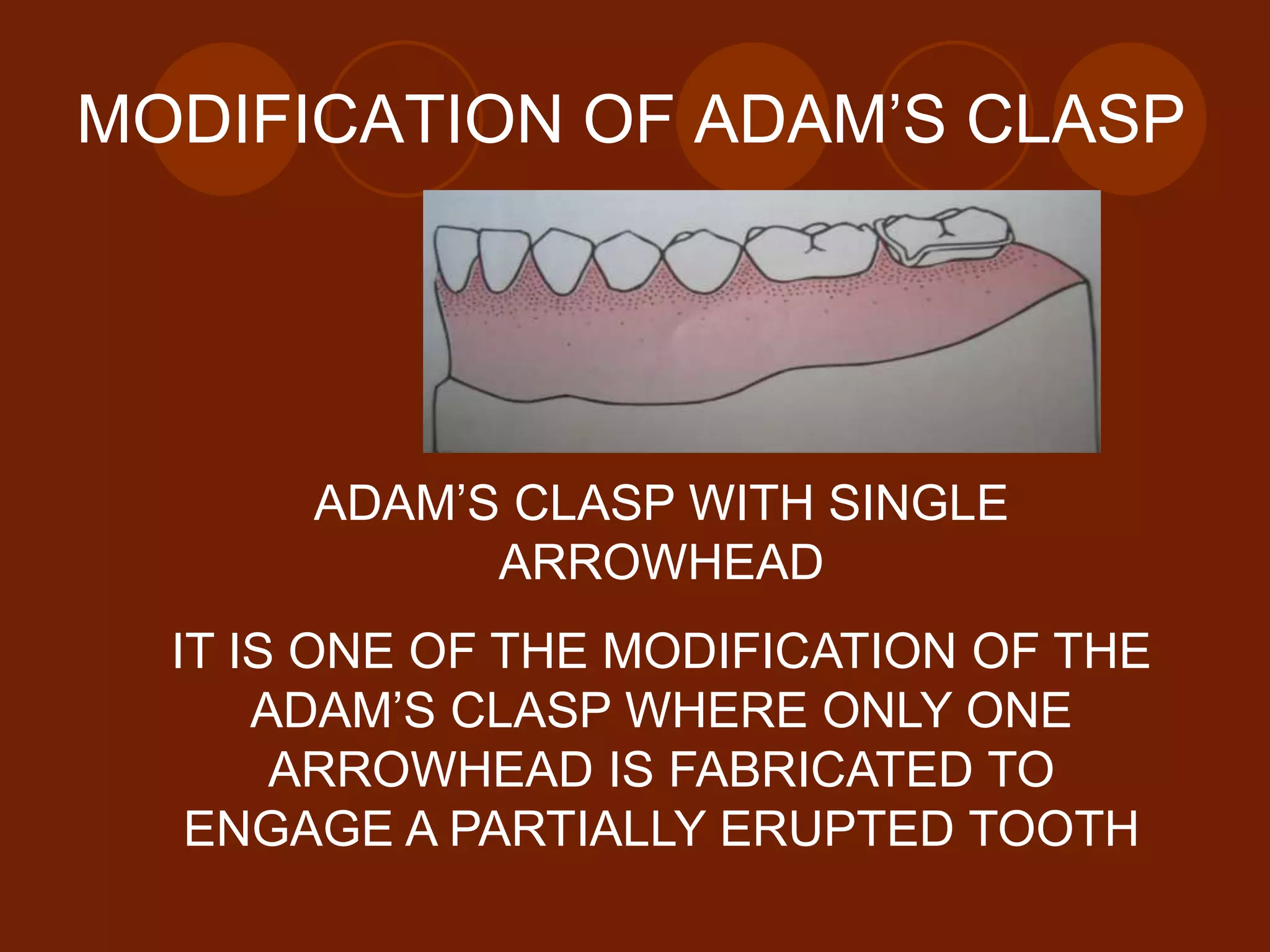 Stainless Steel + Removable Appliances | PPT