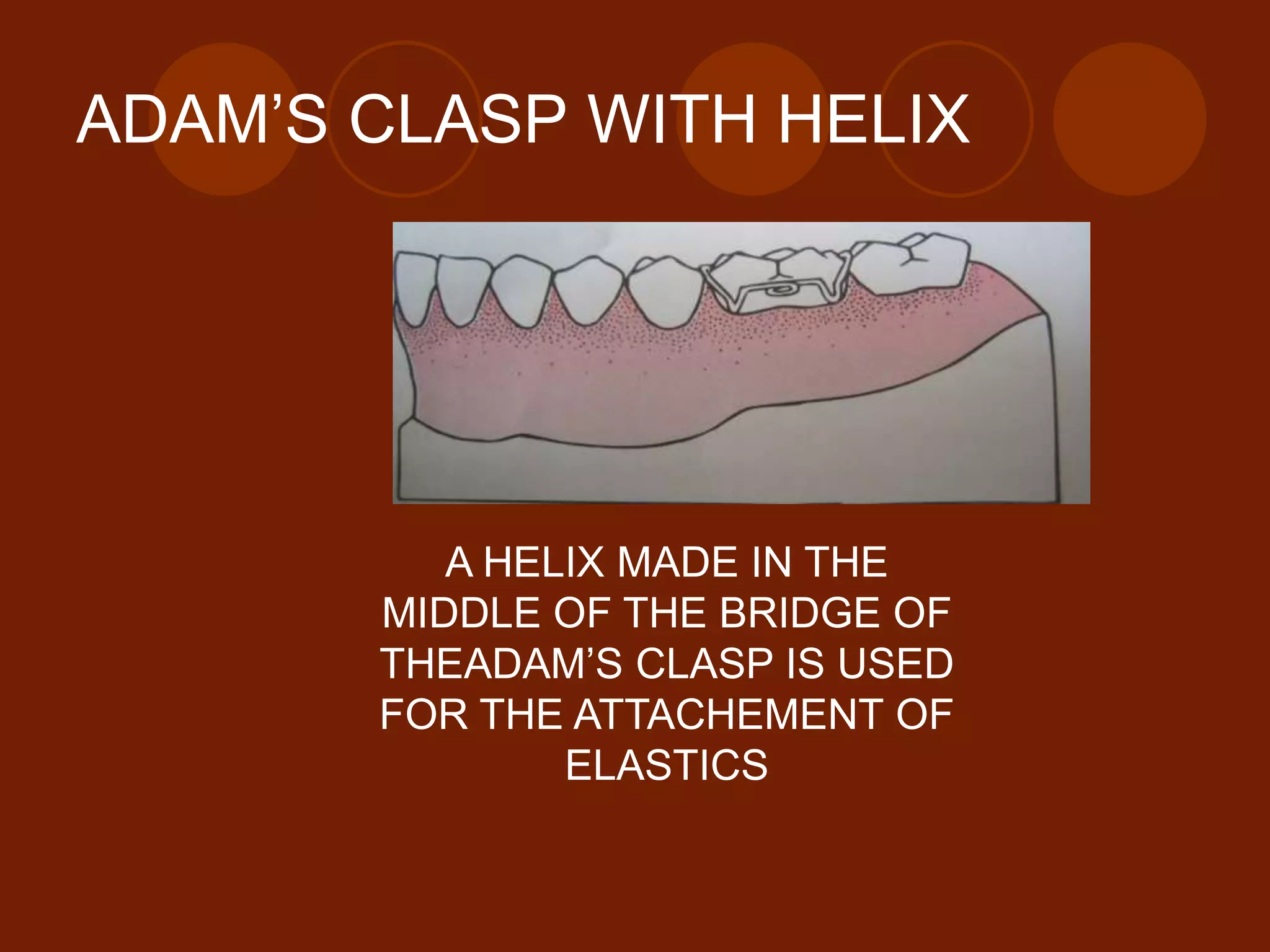 Stainless Steel + Removable Appliances | PPT