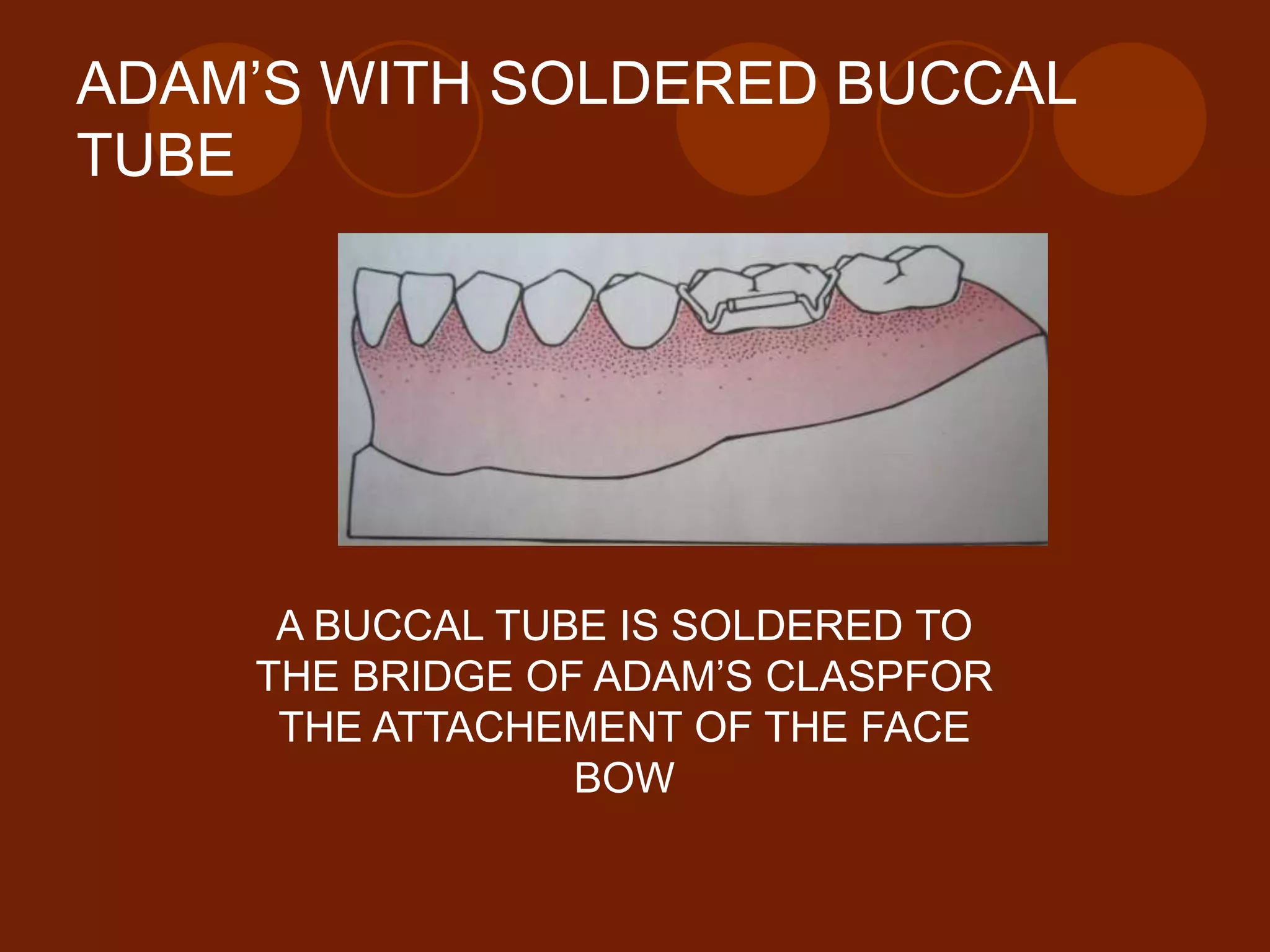 Stainless Steel + Removable Appliances | PPT