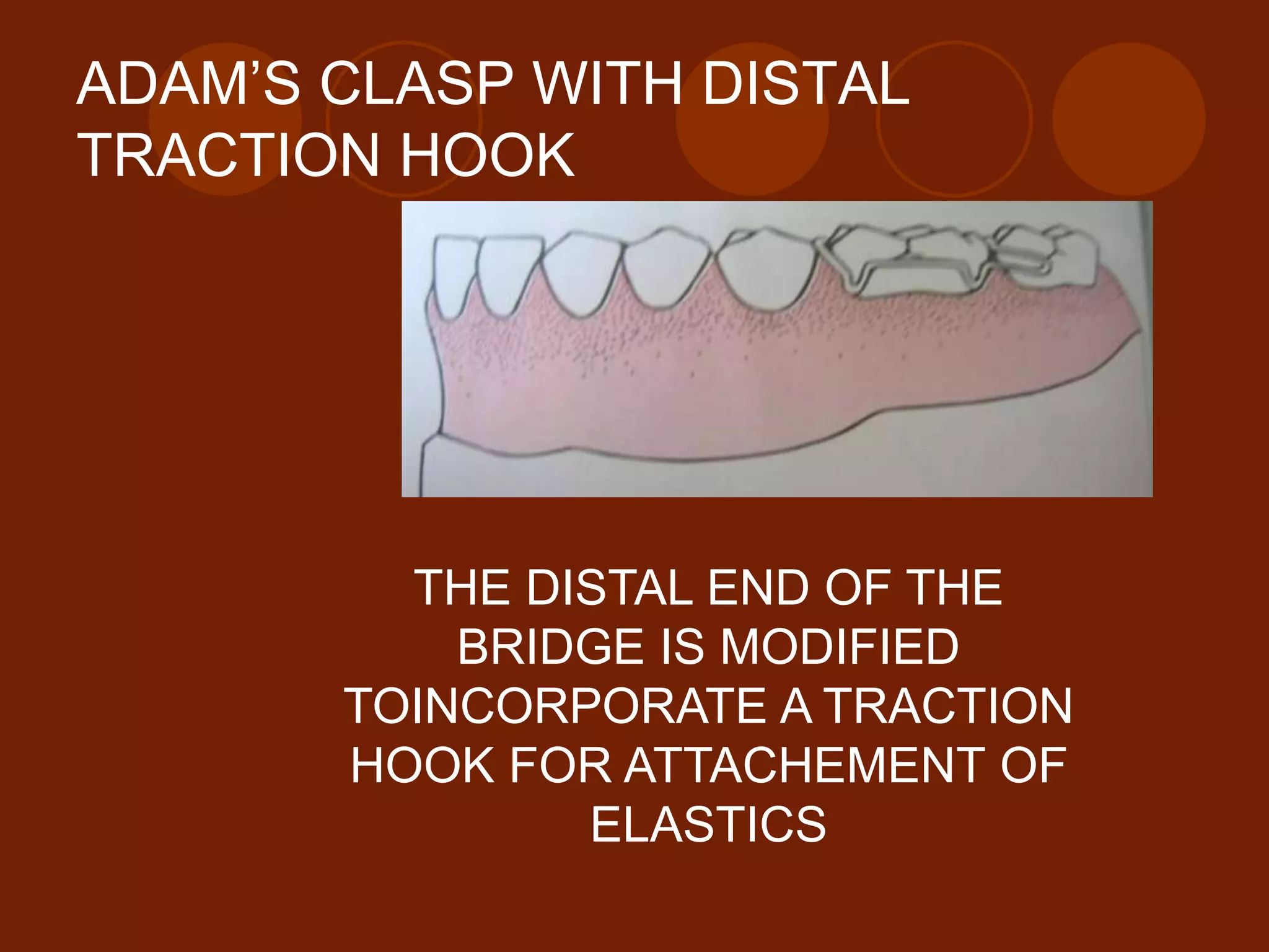 Stainless Steel + Removable Appliances | PPT