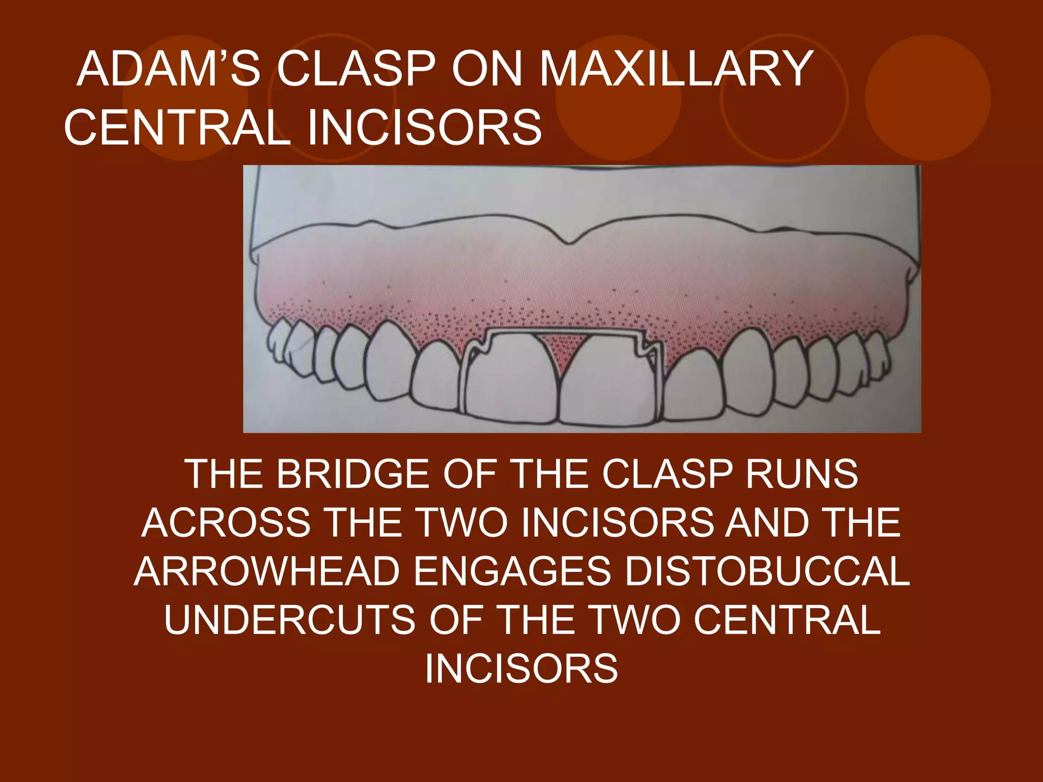 Stainless Steel + Removable Appliances | PPT