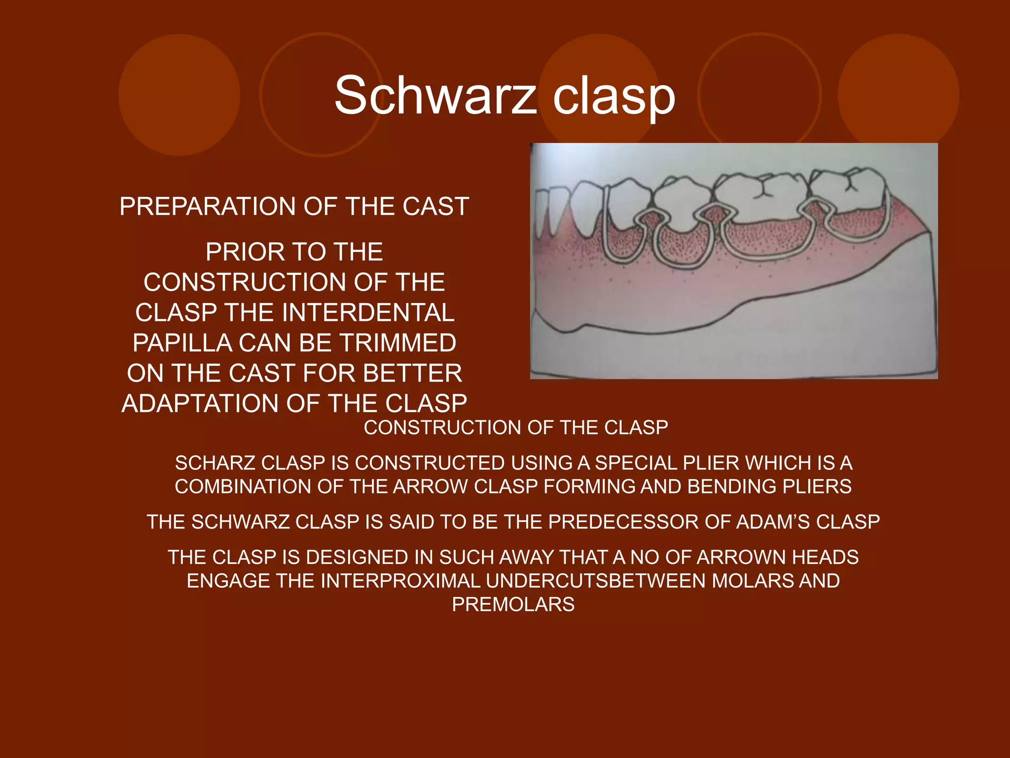 Stainless Steel + Removable Appliances | PPT