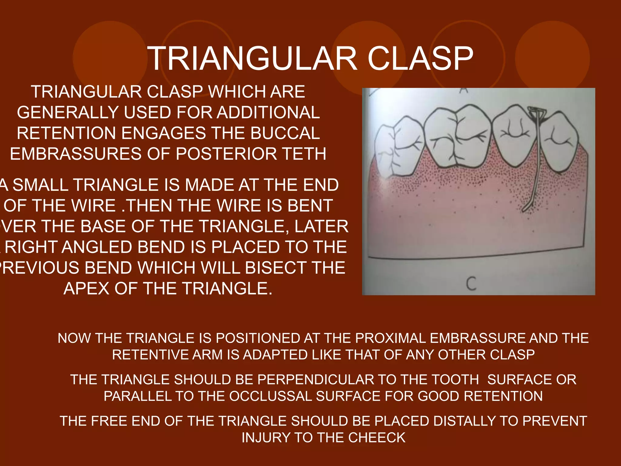 Stainless Steel + Removable Appliances | PPT