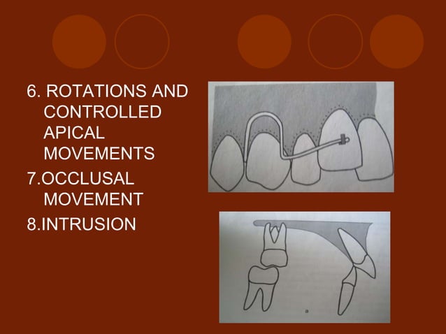 Stainless Steel + Removable Appliances | PPT