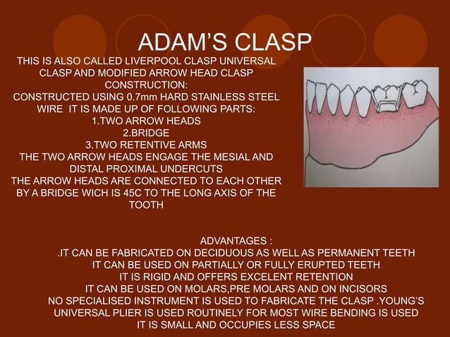 Stainless Steel + Removable Appliances | PPT