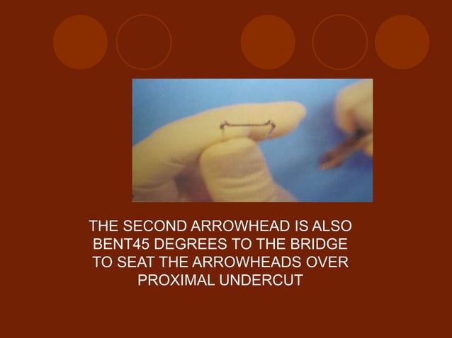 Stainless Steel + Removable Appliances | PPT