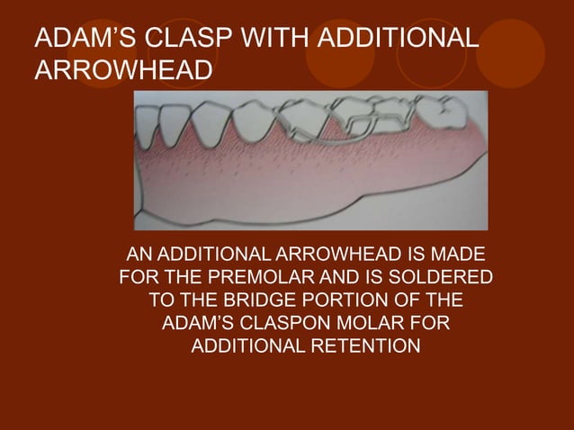 Stainless Steel + Removable Appliances | PPT