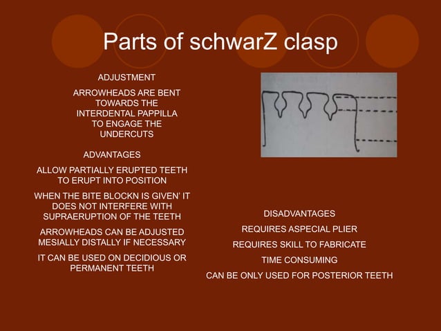 Stainless Steel + Removable Appliances | PPT