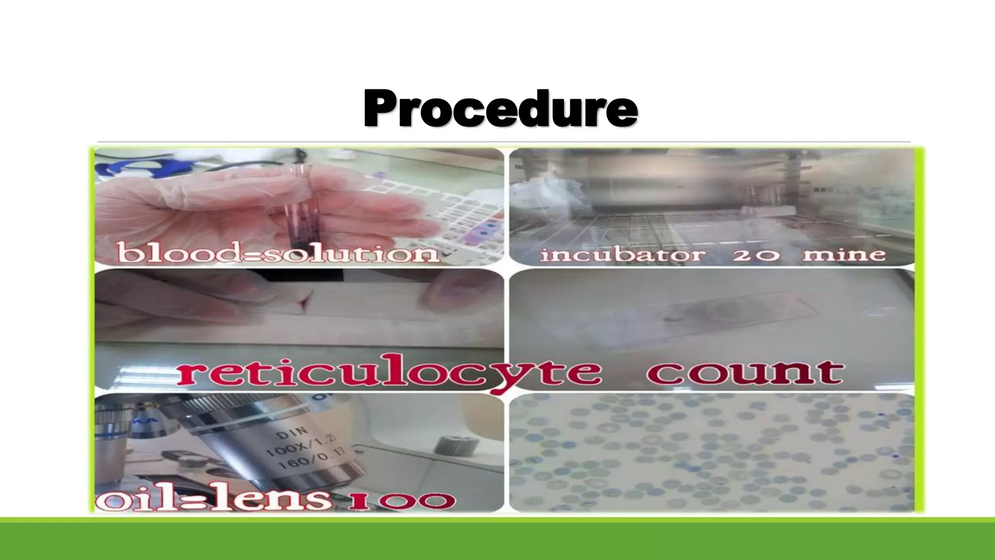 Stain of hematology | PPTX