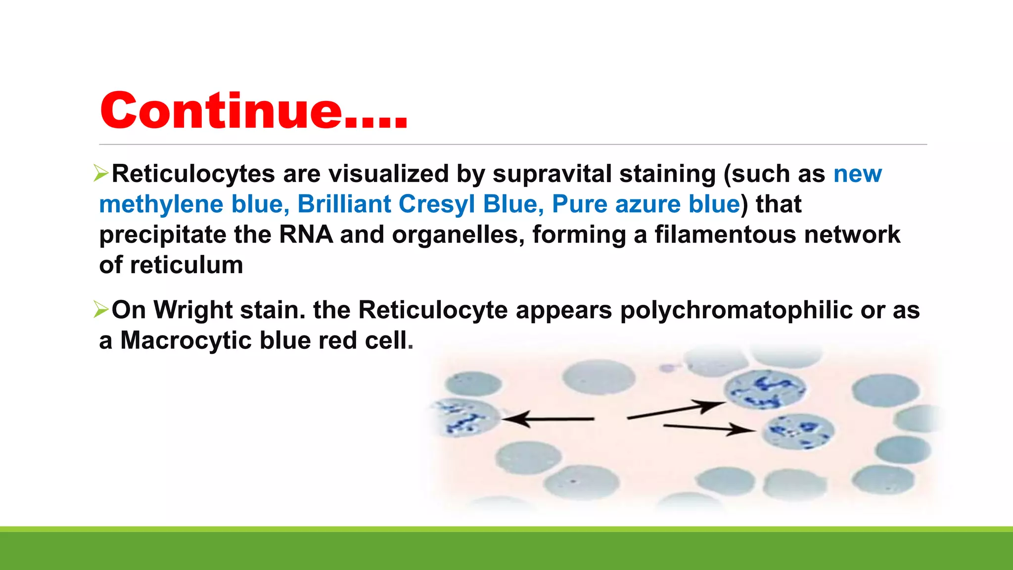 Stain of hematology | PPTX