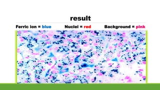 Stain of hematology | PPTX
