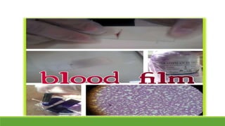 Stain of hematology | PPTX