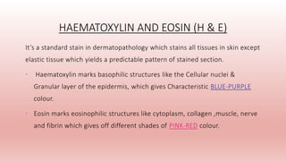 Comprehensive overview of stains in dermatopathology | PPTX