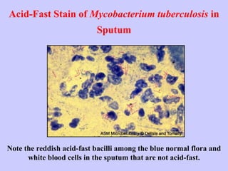 Types of staining techniques in microbiology | PDF