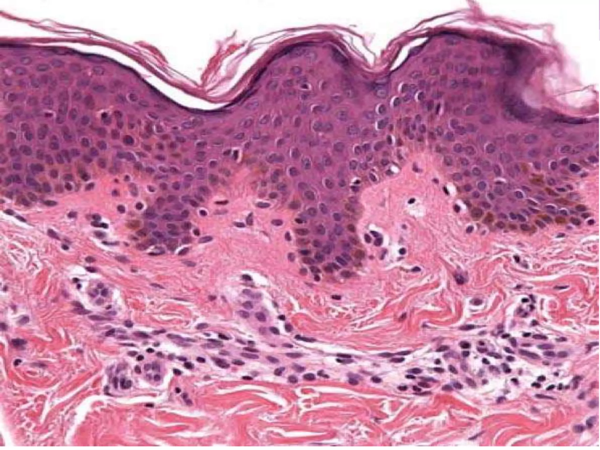 Stains in dermatology | PPTX