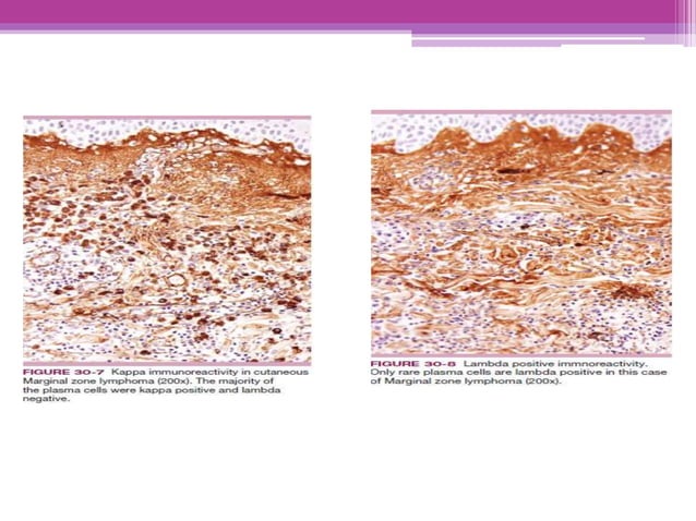 Stains in dermatology | PPT