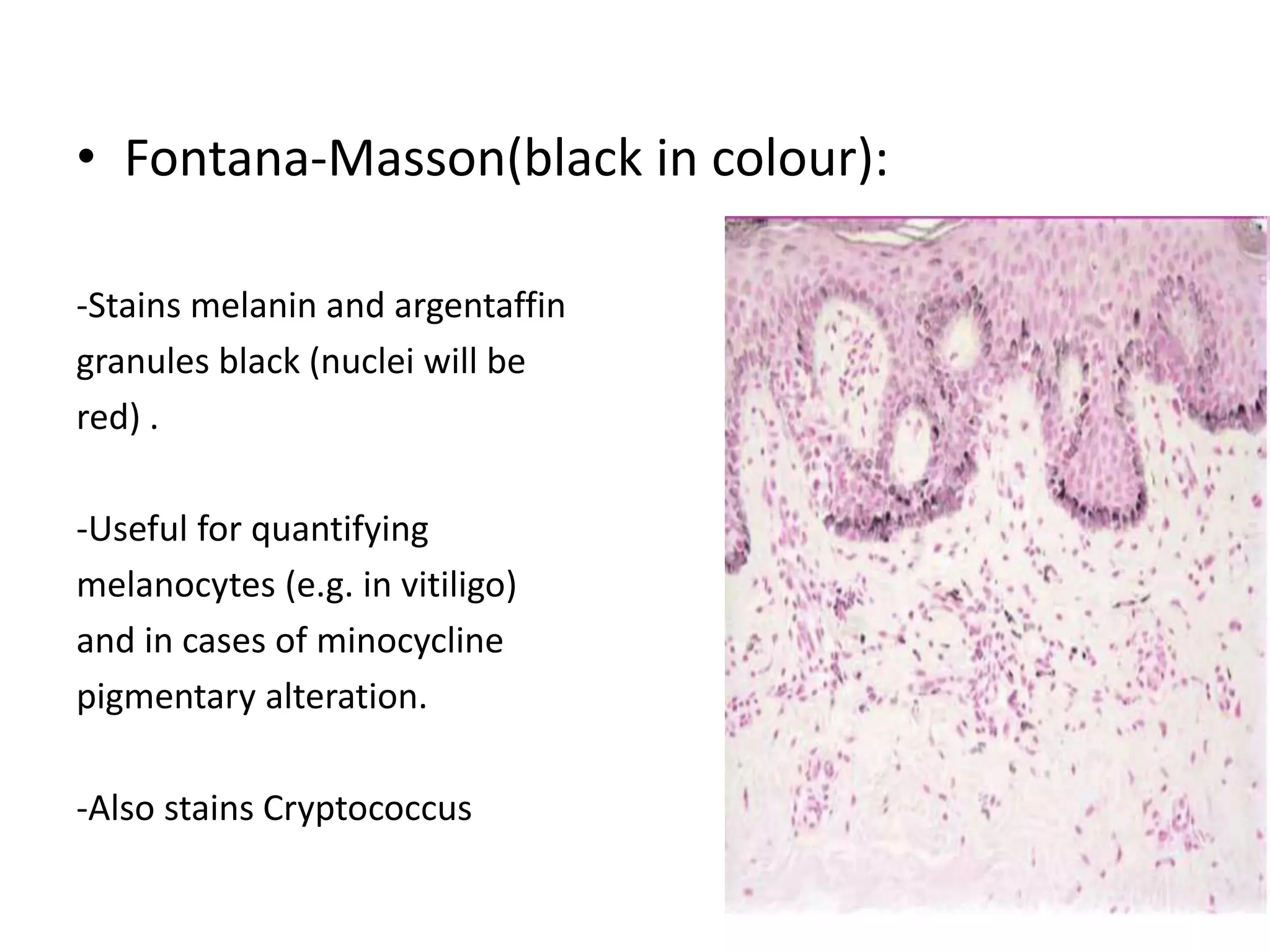 stains in dermatology.pptx