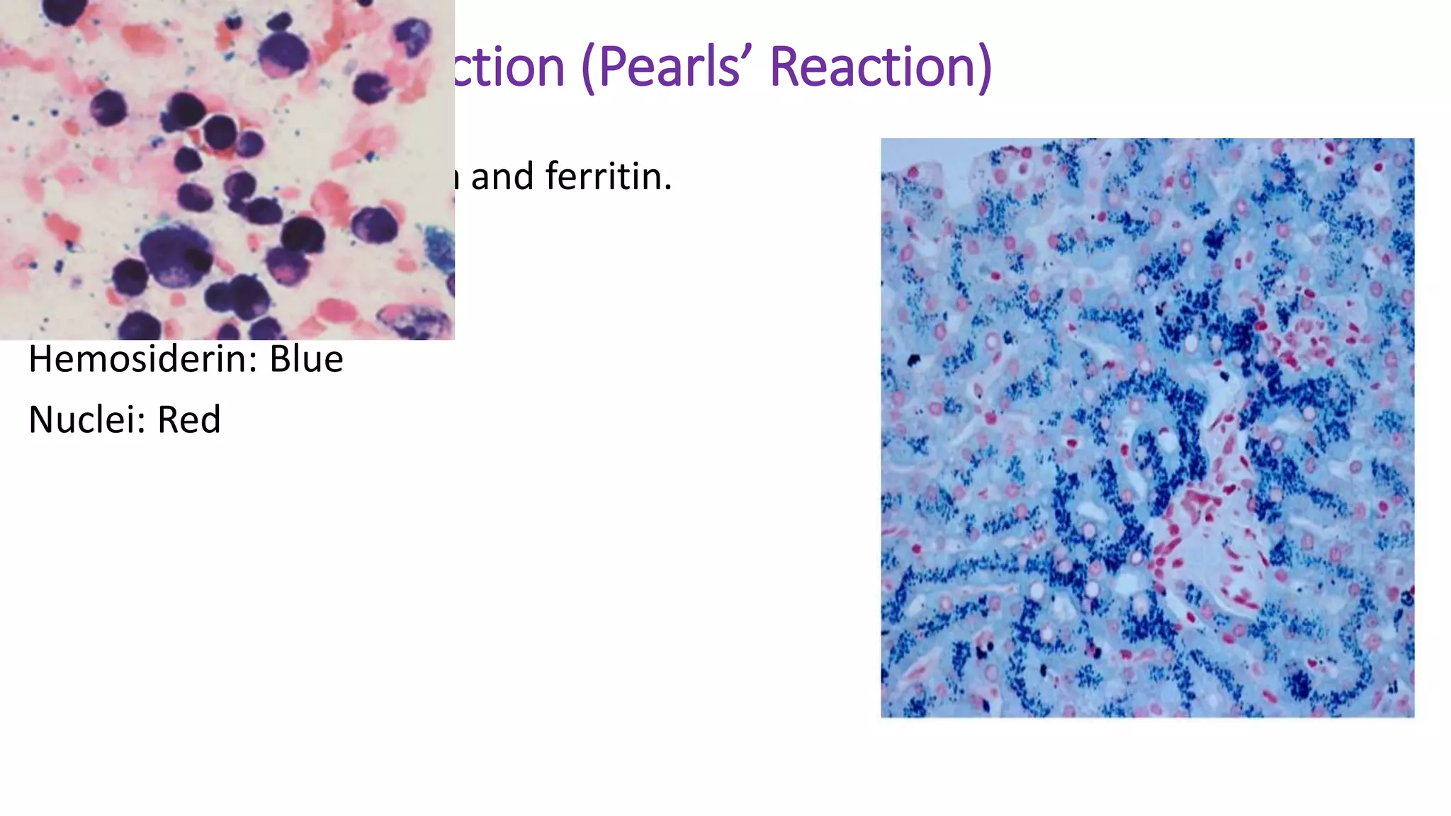 STAINS IN HISTOPATHOLOGY.pptx