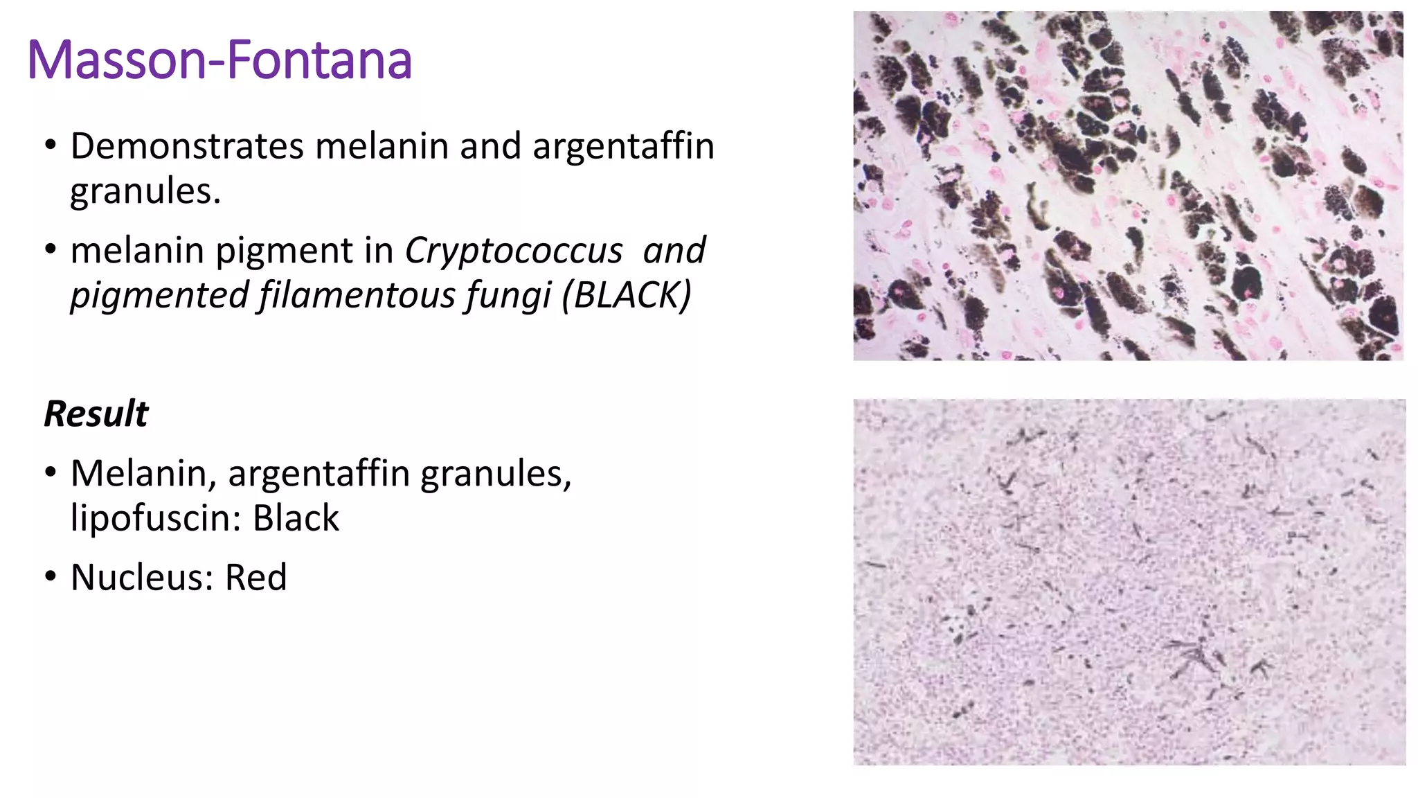 STAINS IN HISTOPATHOLOGY.pptx