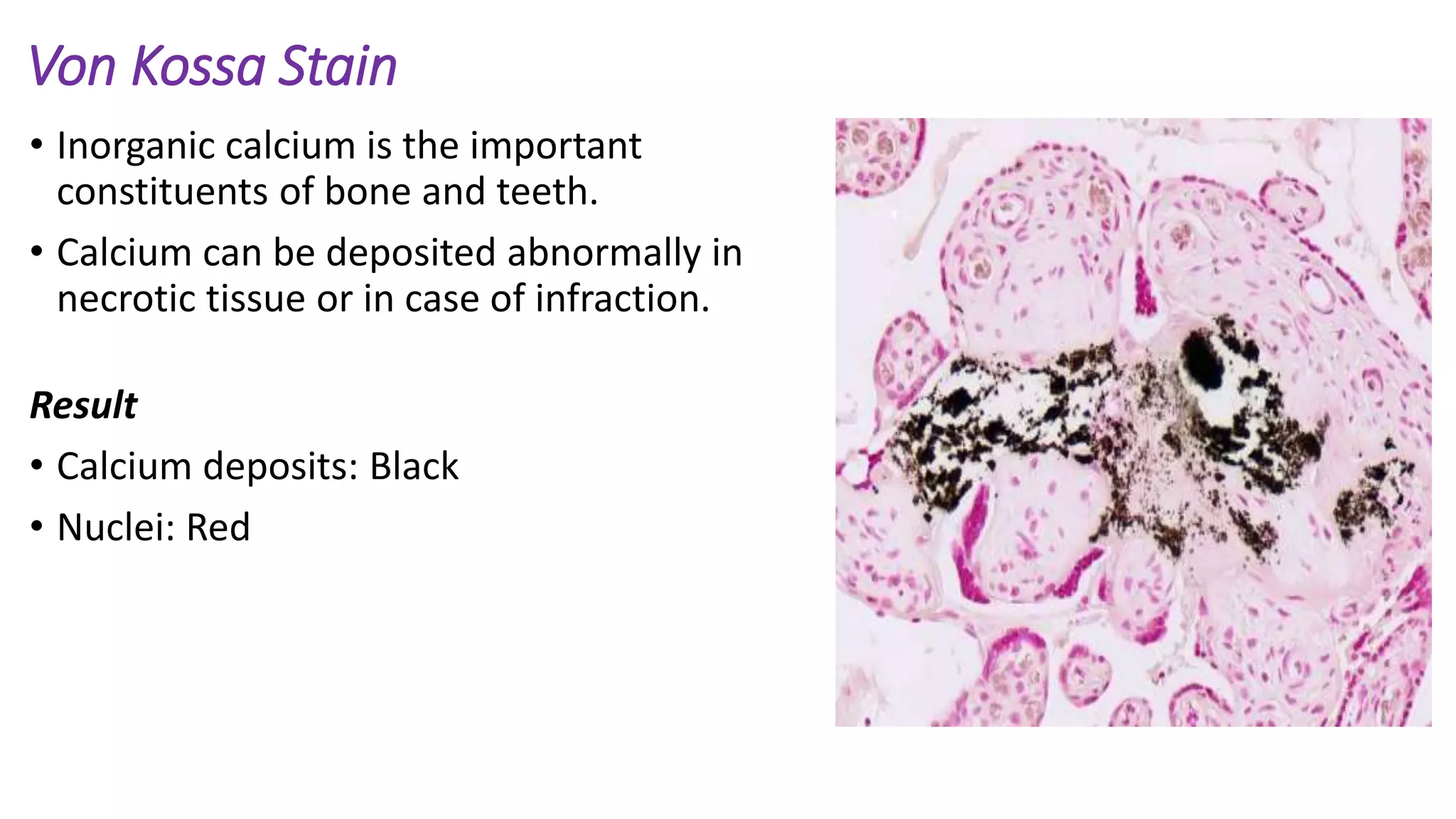 STAINS IN HISTOPATHOLOGY.pptx