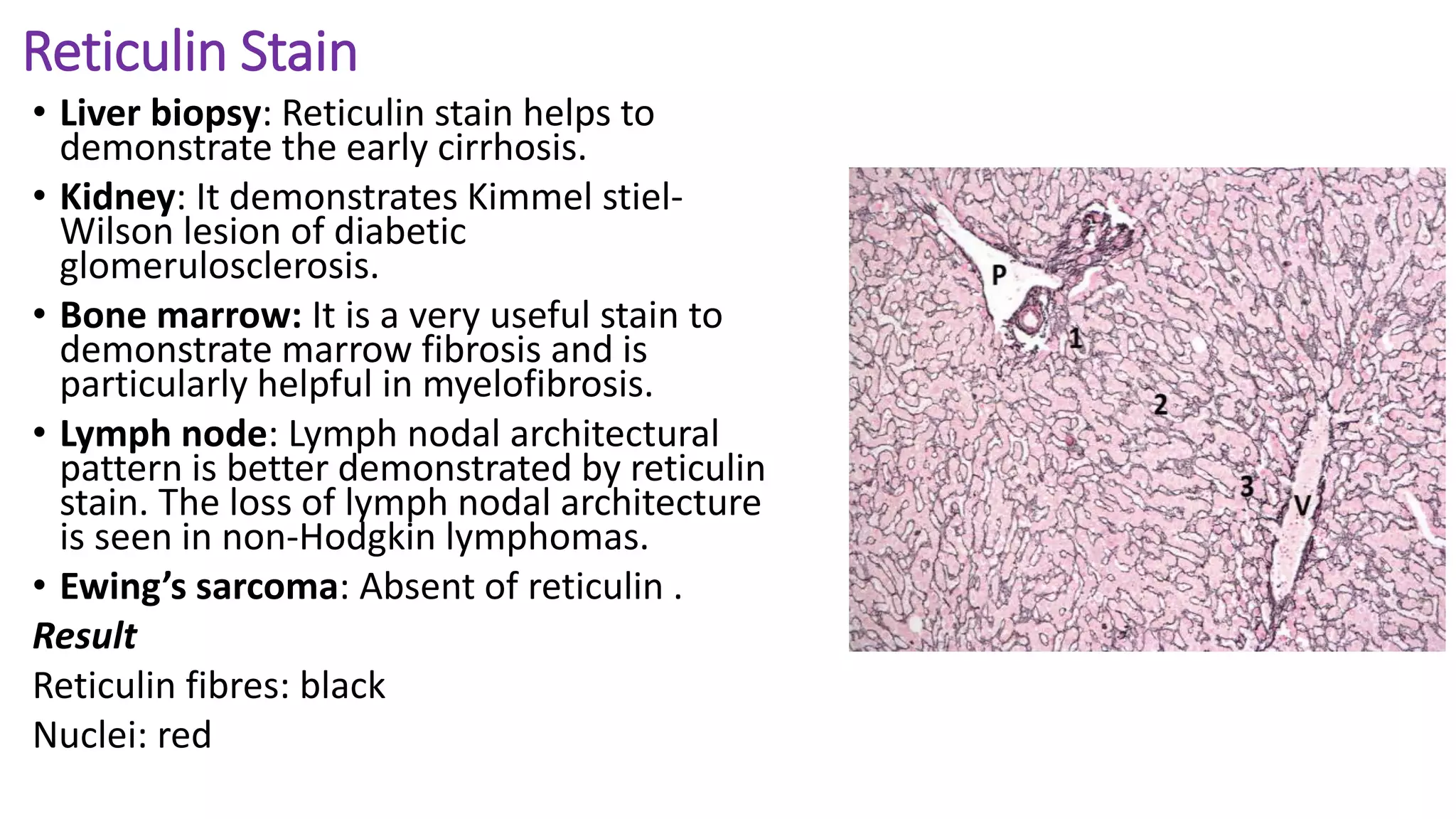 STAINS IN HISTOPATHOLOGY.pptx