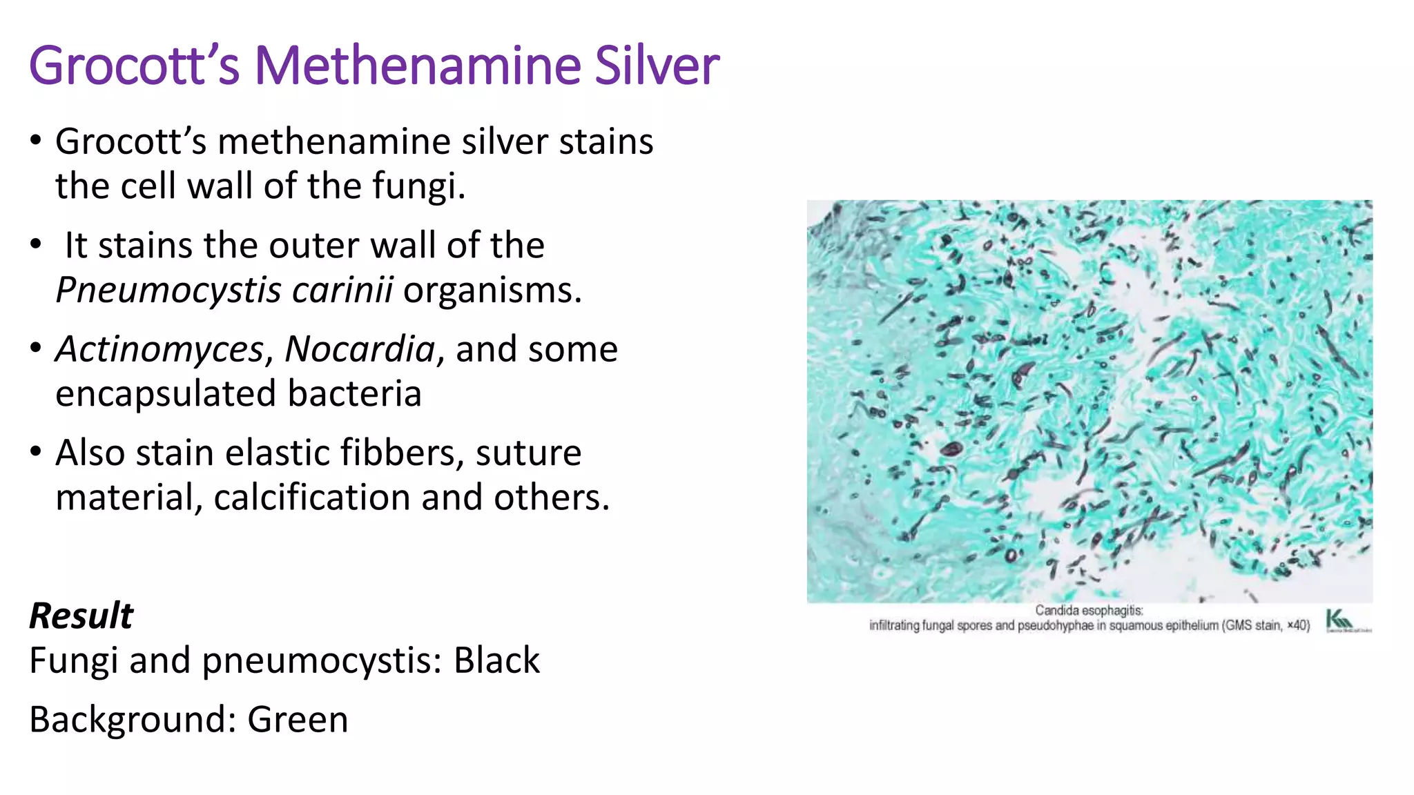 STAINS IN HISTOPATHOLOGY.pptx