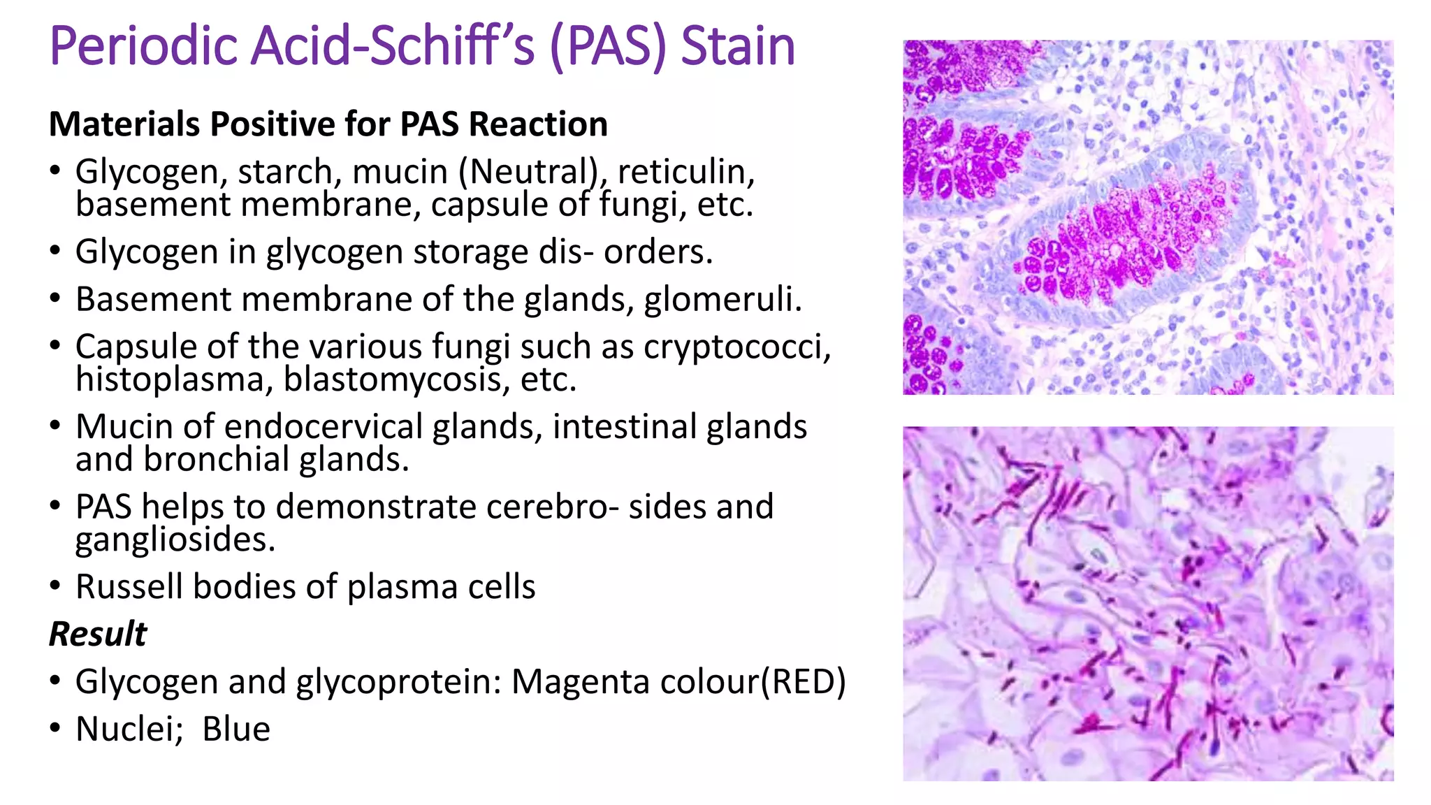 STAINS IN HISTOPATHOLOGY.pptx