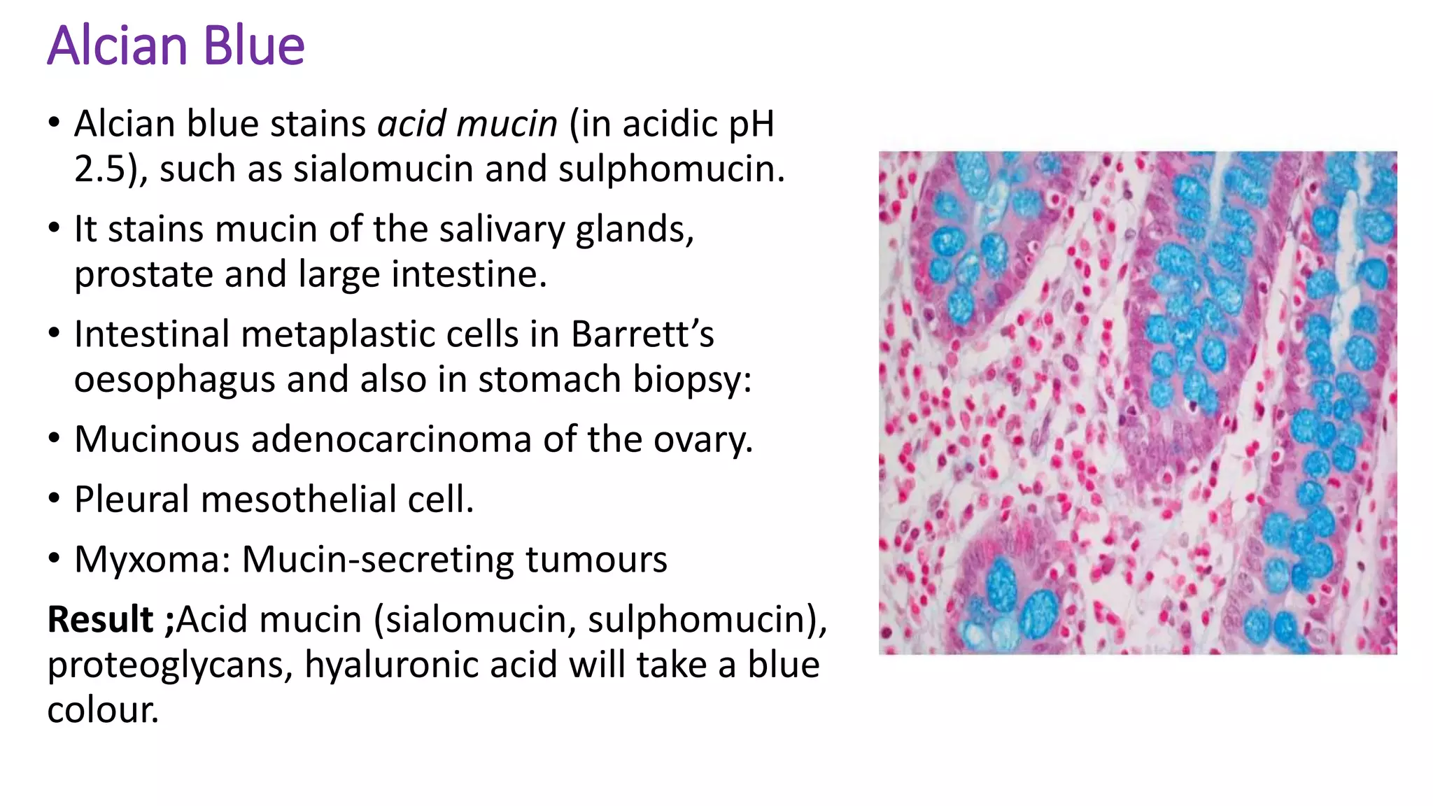 STAINS IN HISTOPATHOLOGY.pptx