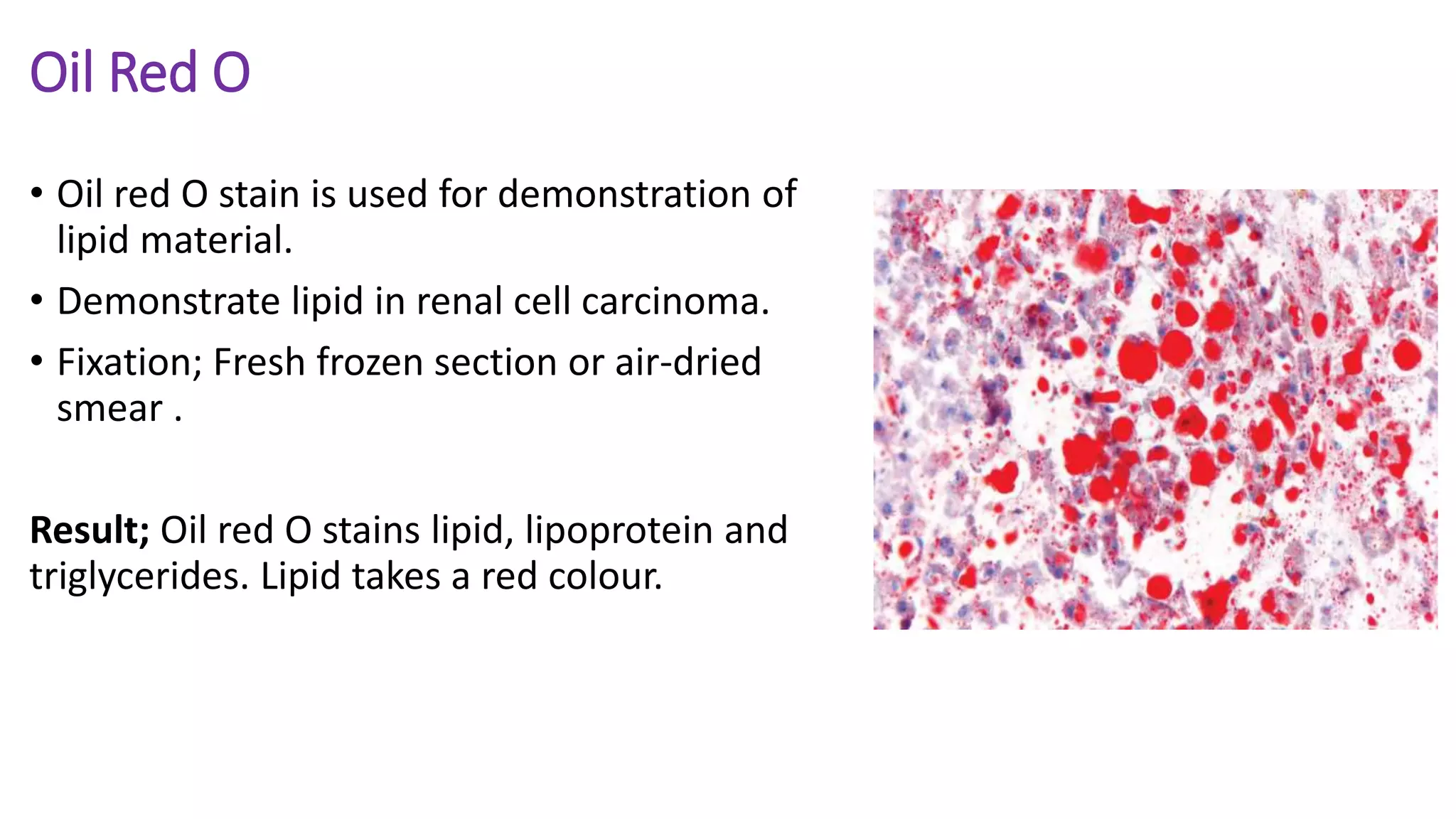 STAINS IN HISTOPATHOLOGY.pptx