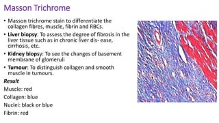 STAINS IN HISTOPATHOLOGY.pptx