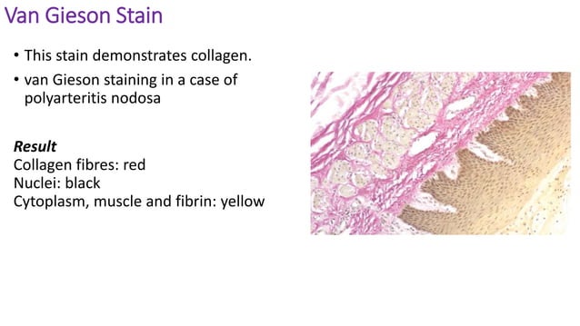 STAINS IN HISTOPATHOLOGY.pptx