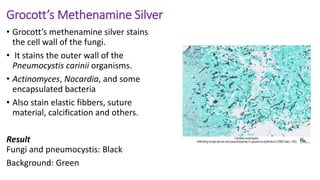 STAINS IN HISTOPATHOLOGY.pptx
